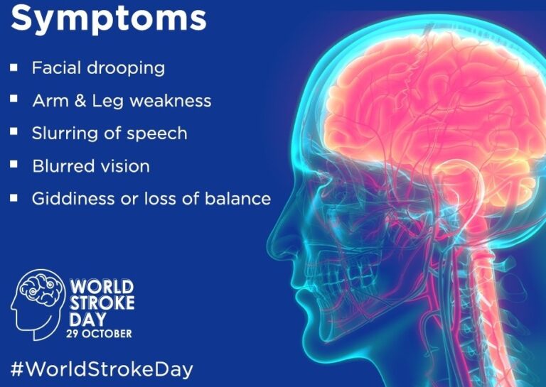 What is stroke? Symptoms and prevention - Health Vision
