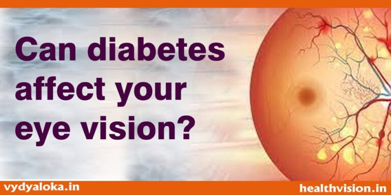 Diabetic eye disease - How it affects your eye vision? - Health Vision