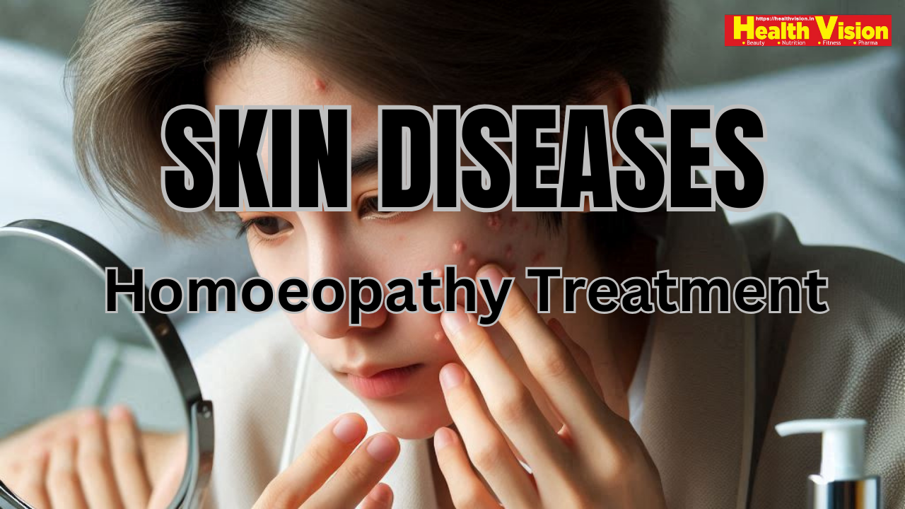 Skin Diseases: Homoeopathy for Dermatological Health